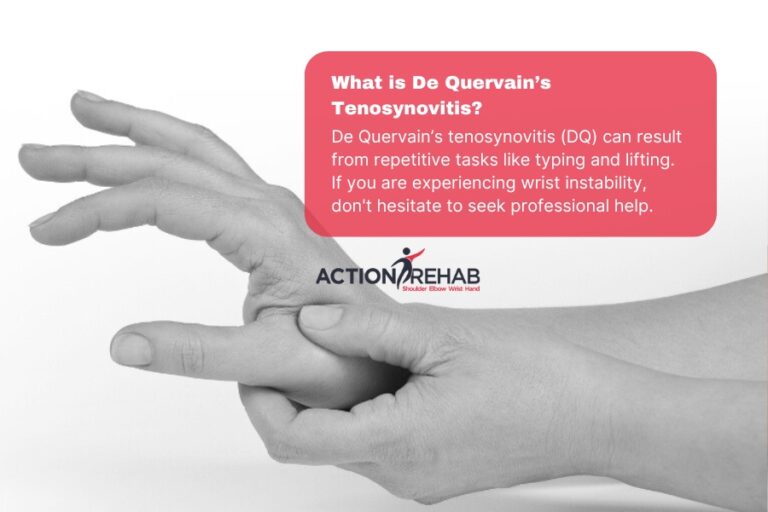 De Quervain’s Tenosynovitis and Scapholunate Instability Action Rehab