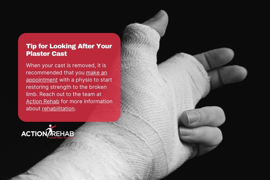 Tips for Looking After Your Plaster Cast | Action Rehab